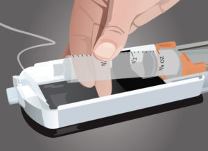FreedomEDGE® infusion pumps for easy at-home infusions