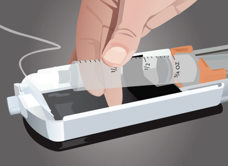 FreedomEDGE® infusion pumps for easy at-home infusions